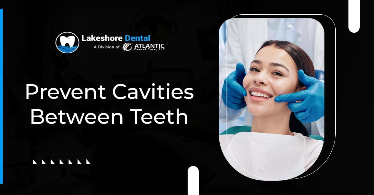 Cavities Between Teeth: How to Prevent and Treat Hidden Dental Decay